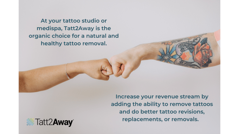 Become A Licensed Location - Tattoo Removal by Tatt2Away