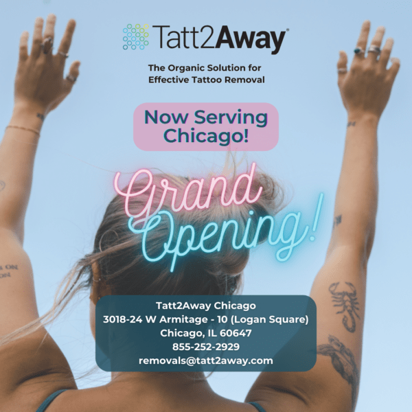 Tattoo Removal in Chicago, Illinois - Tatt2Away®