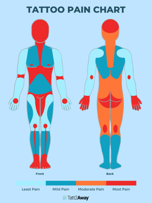 Does Tattoo Removal Hurt? How Painful Is It? - Tatt2Away