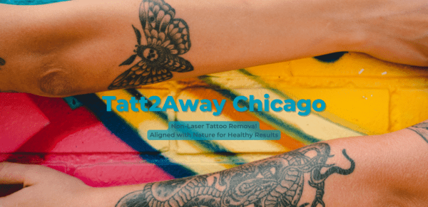 Tatt2Away® - Non-Laser Tattoo Removal and Revision