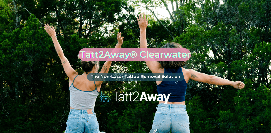 Tatt2Away® - Non-Laser Tattoo Removal and Revision