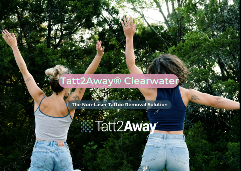 Tatt2Away® - Non-Laser Tattoo Removal and Revision
